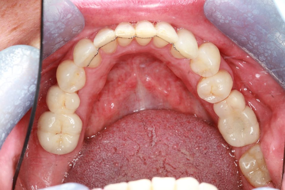 Lower arch - Private Dentistry