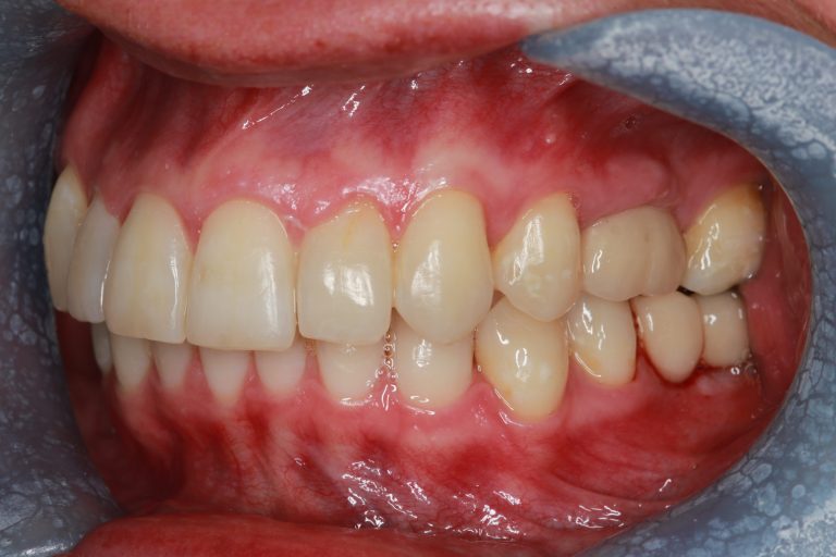 Side view - Private Dentistry